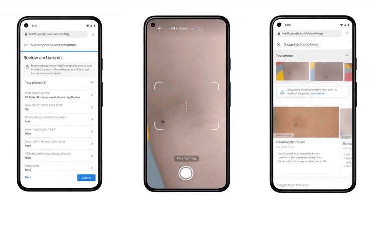 Google планує запустити додаток для виявлення хвороб шкіри • PIK